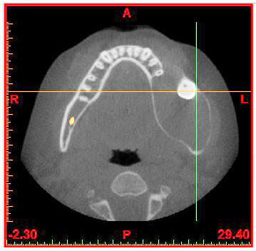 CT Protocol - MedCAD