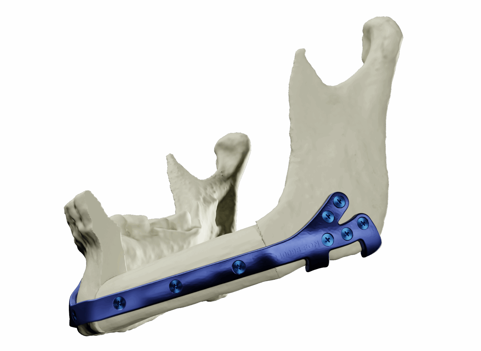 Custom Medical Solutions - MedCAD